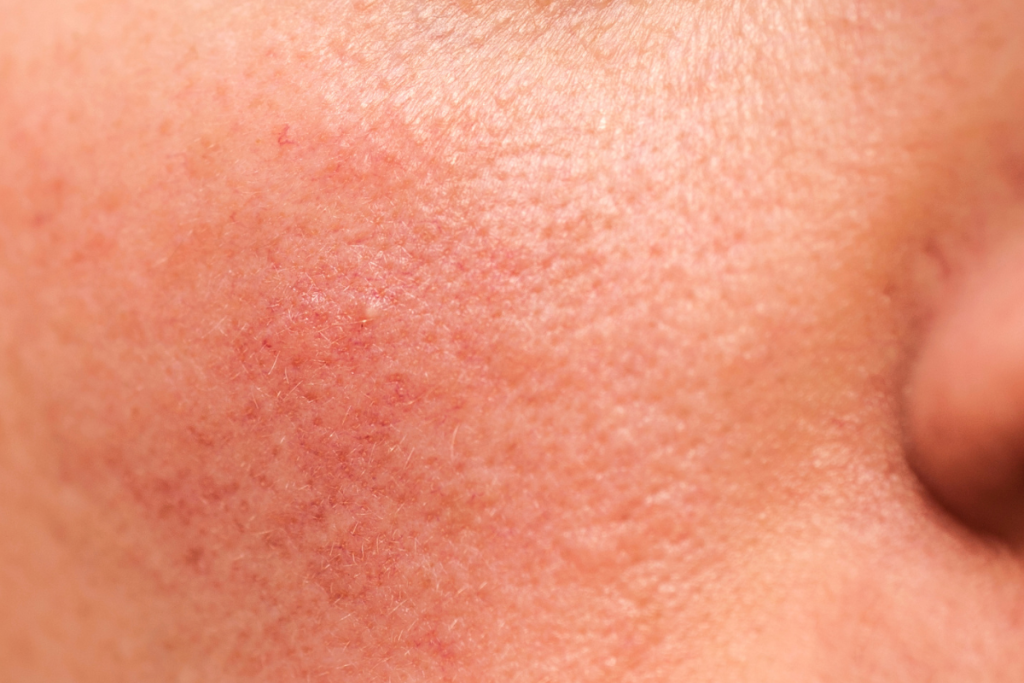 Alert! 6 Kebiasaan Harian Ini Tanpa Sadar Merusak Kulitmu